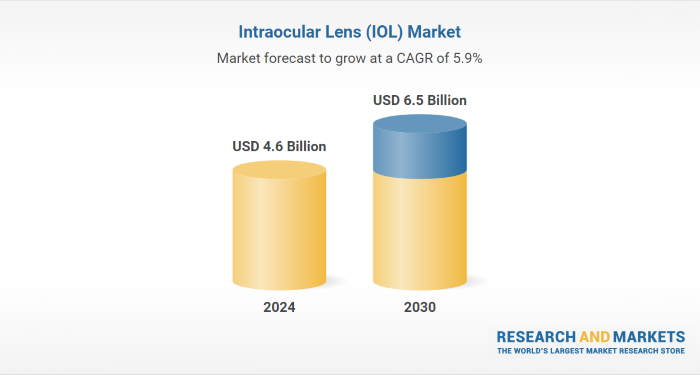 Research and Markets' New Report Reveals Global Intraocular Lens Market ...