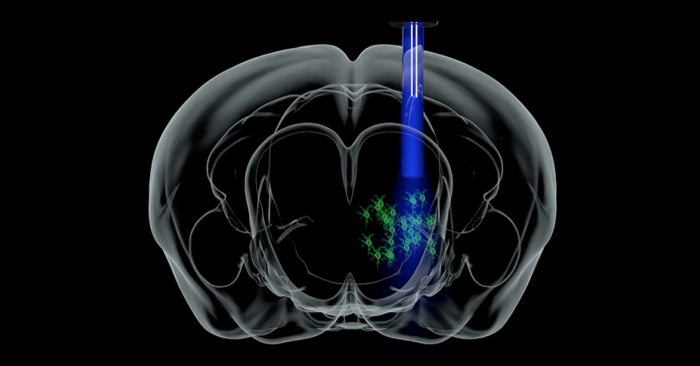 Bruker Corporation Acquires Inscopix for Neuroscience Research